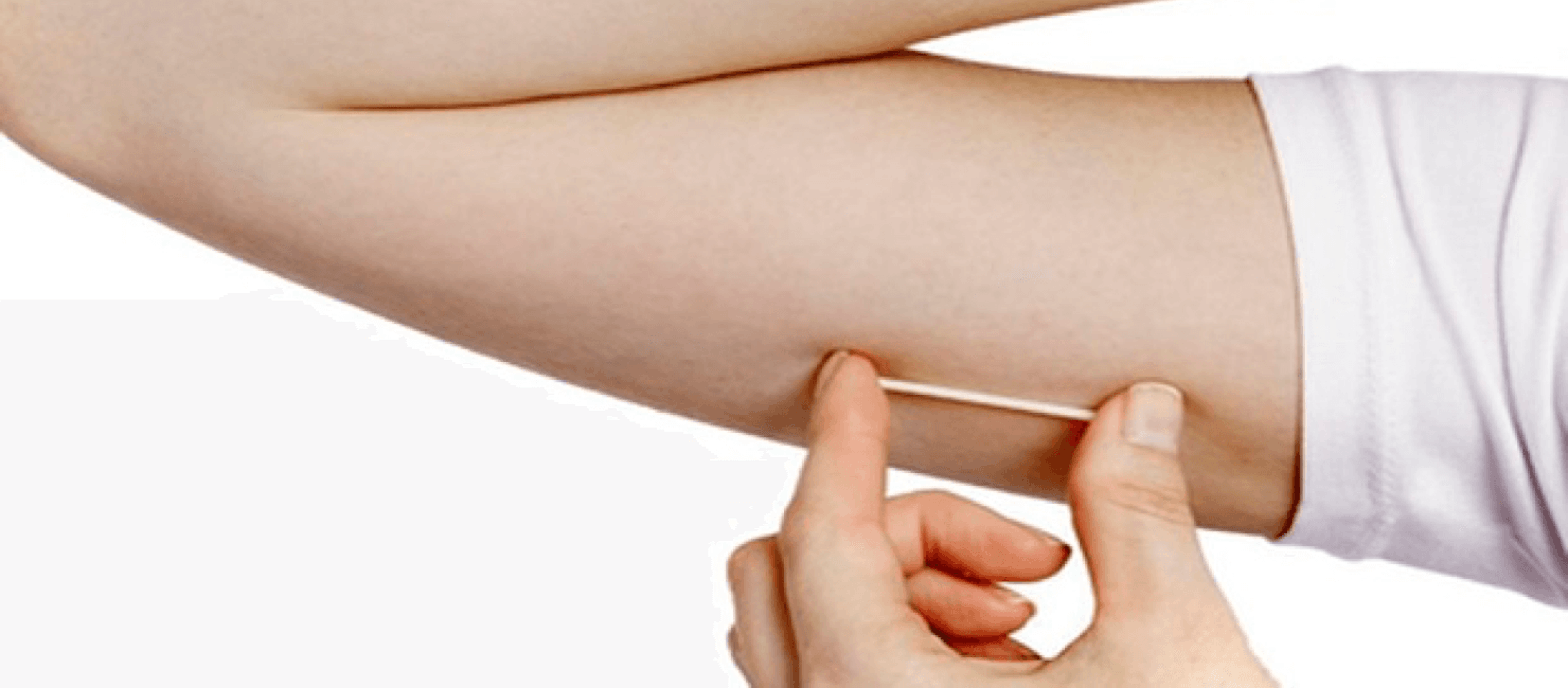 Birth Control Implant - Nurx™