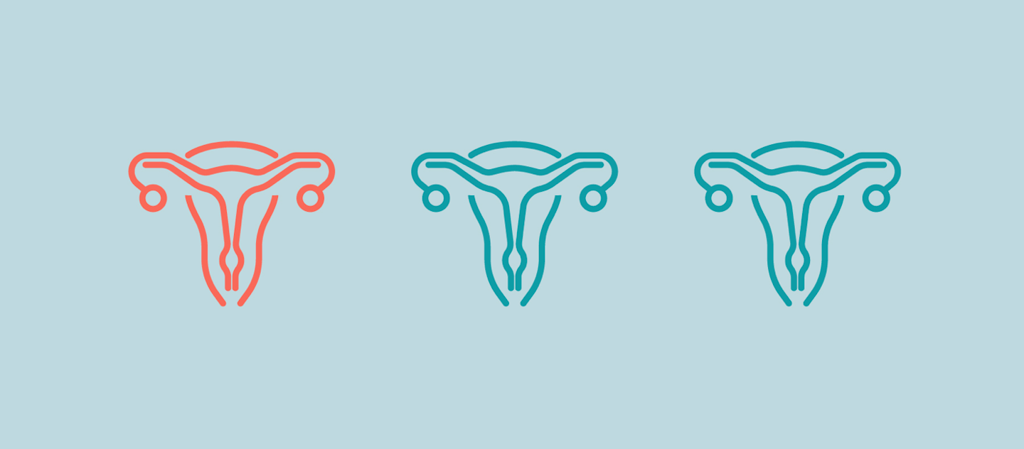Birth Control and Uterus Didelphys - Nurx™