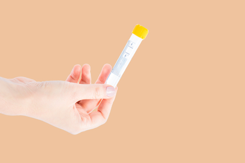 HPV At Home Test Kit with Free Delivery - Nurx™