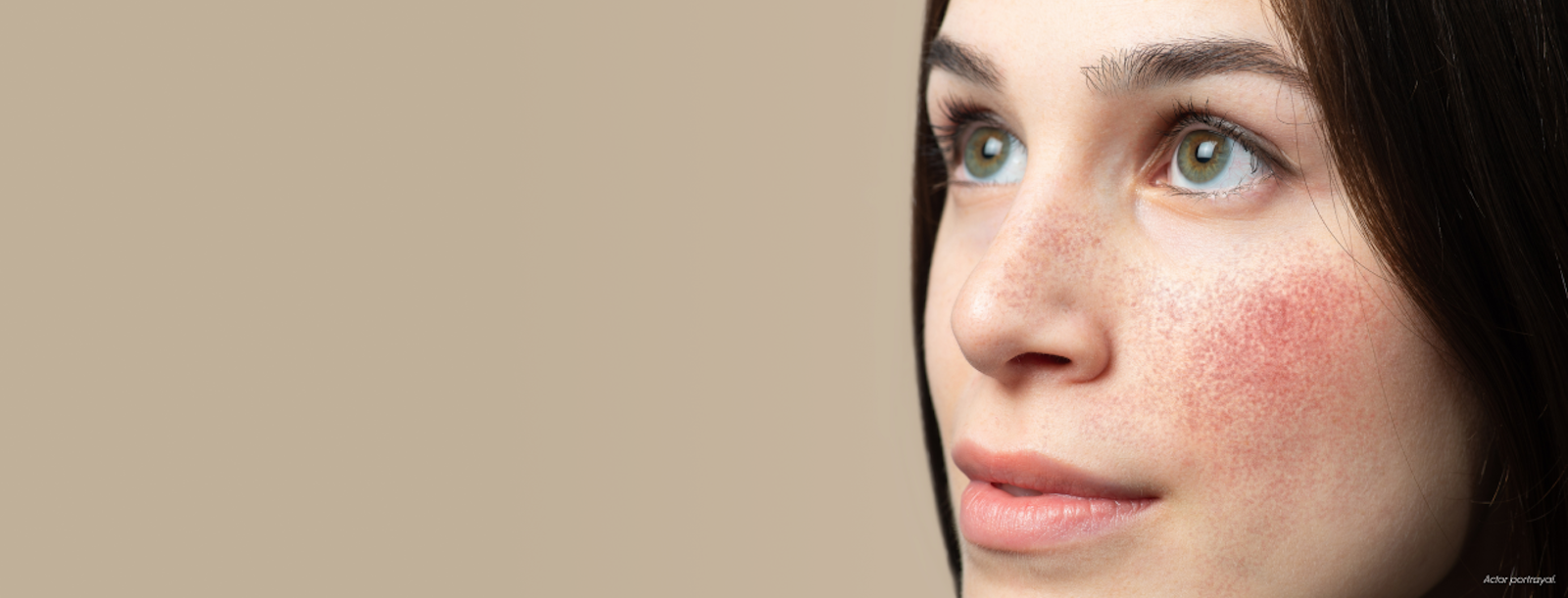 Azithromycin - Nurx™