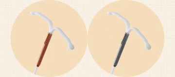 Kyleena vs. Mirena: Comprehensive IUD Comparison | Nurx